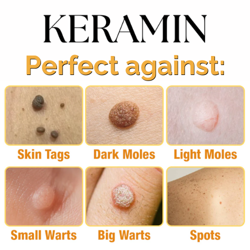 KERAMIN [HU] | EVD – Special Offers 365